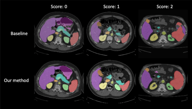 Semi-Supervised Multi-Organ Segmentation through Quality Assurance Supervision | Medical-image ...