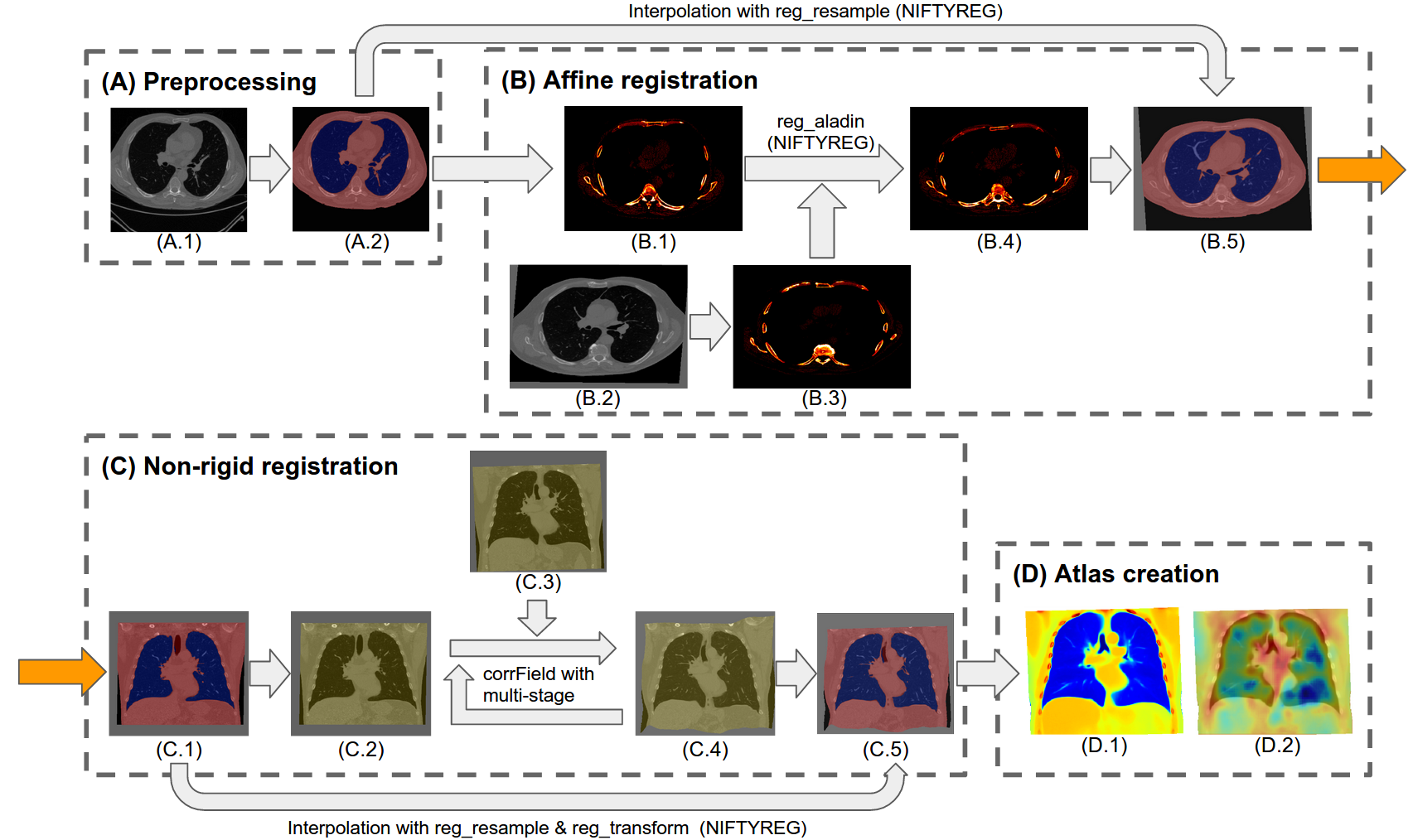 Development and Characterization of a Chest CT Atlas | Medical-image ...