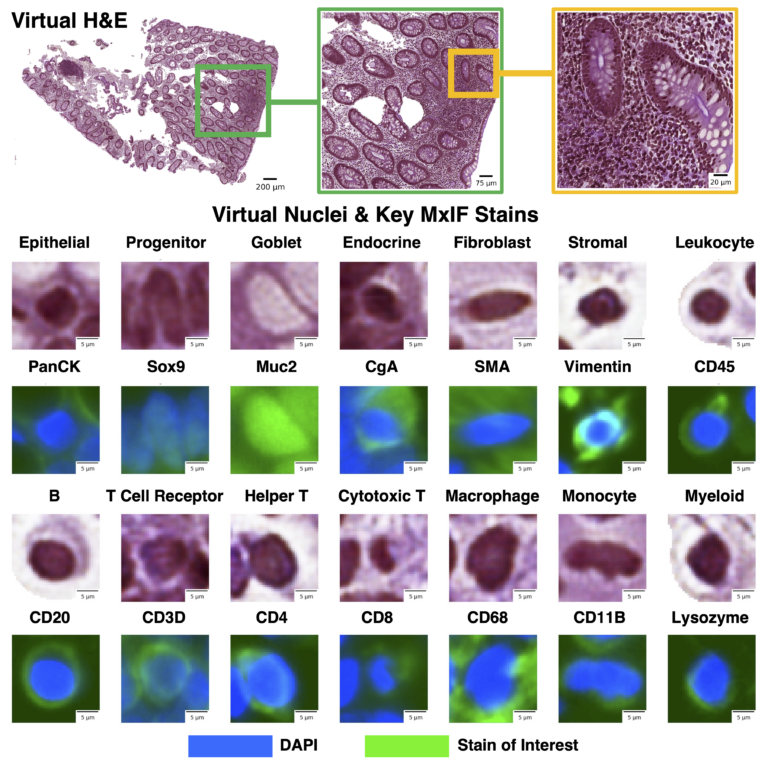 Image Segmentation | Medical-image Analysis and Statistical ...